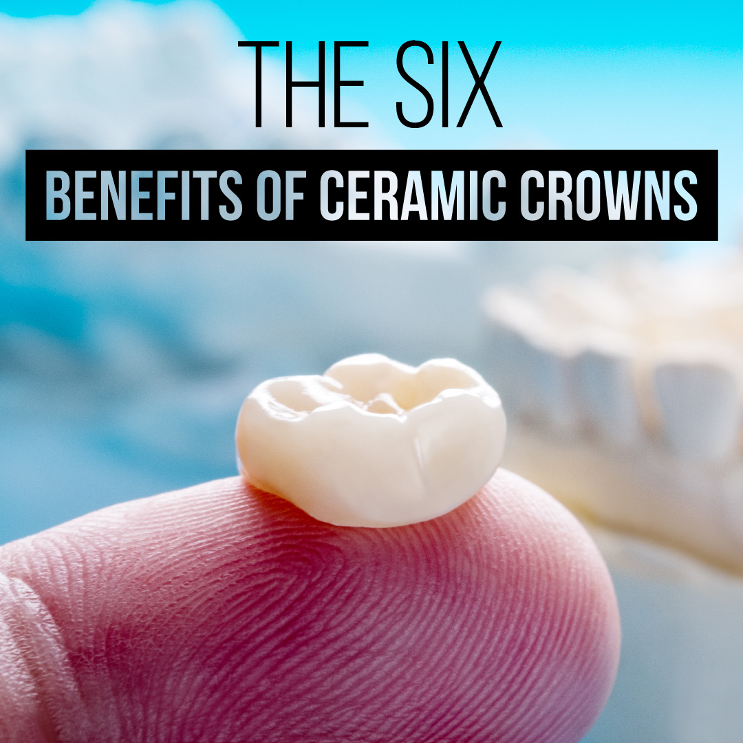 Ceramic Crowns | Christopher Comer DMD | Savannah, GA
